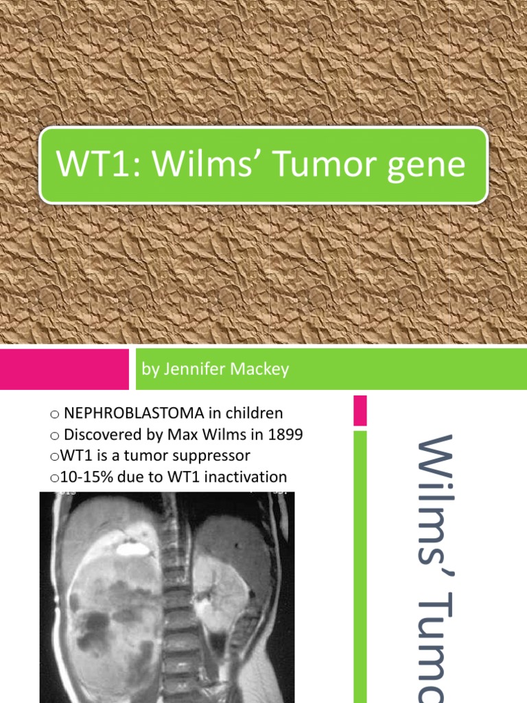Wt1 Wilms Tumor Gene By Jennifer Mackey Pdf Cellular Processes