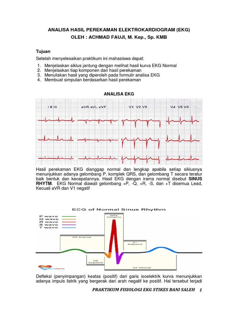 Analisa EKG | PDF