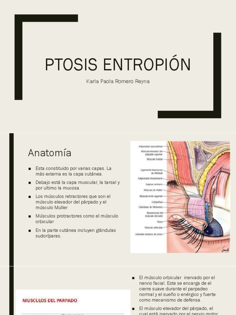 Entropión y Ectropión: Causas y Tratamientos | PDF | Oftalmología ...
