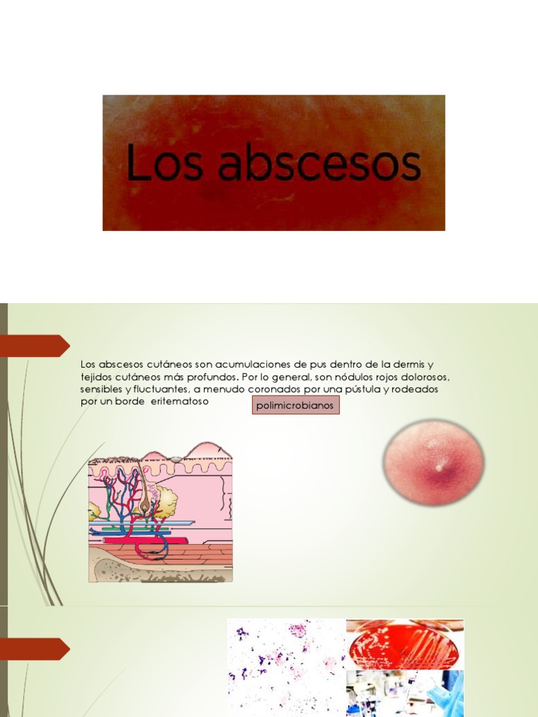 Abscesos Cutaneos Si | PDF | Rtt | Medicina