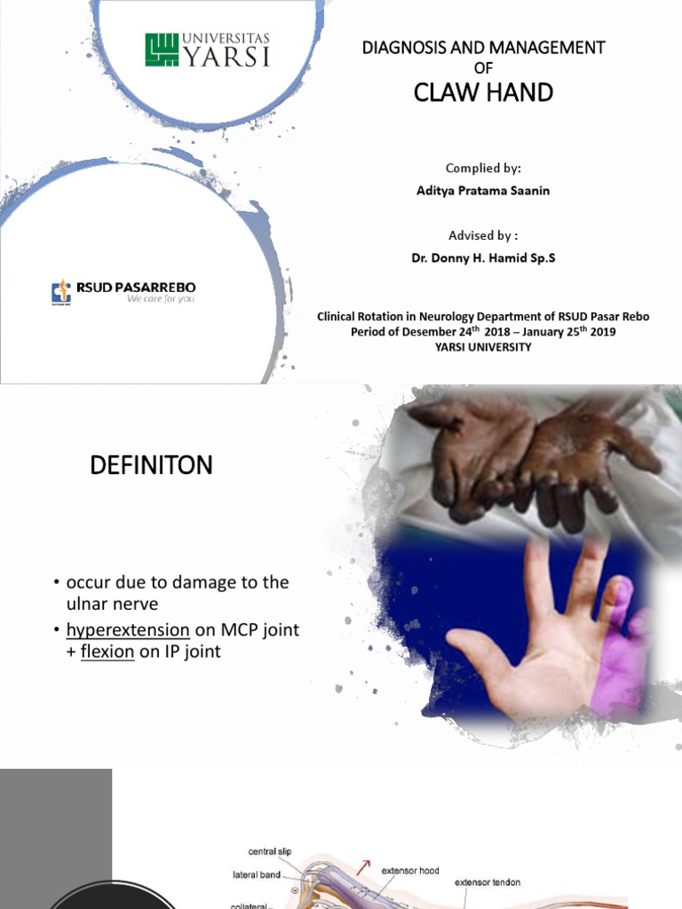 Claw Hand: Diagnosis and Management | PDF | Finger | Paresthesia