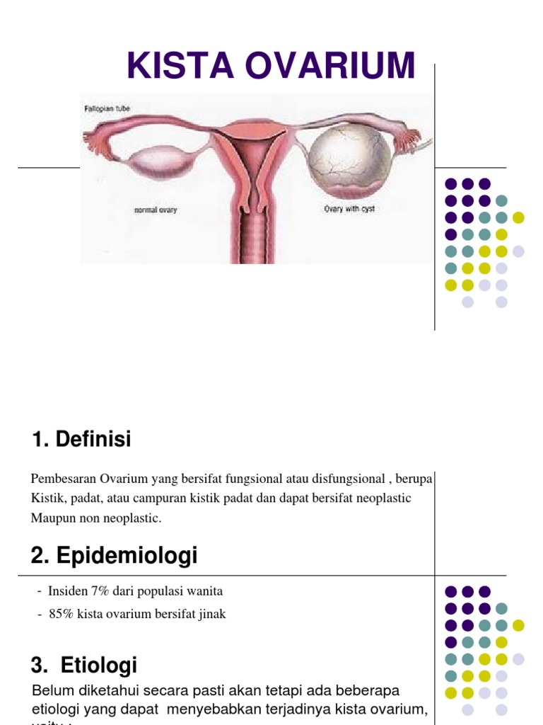 Kista Ovarium | PDF