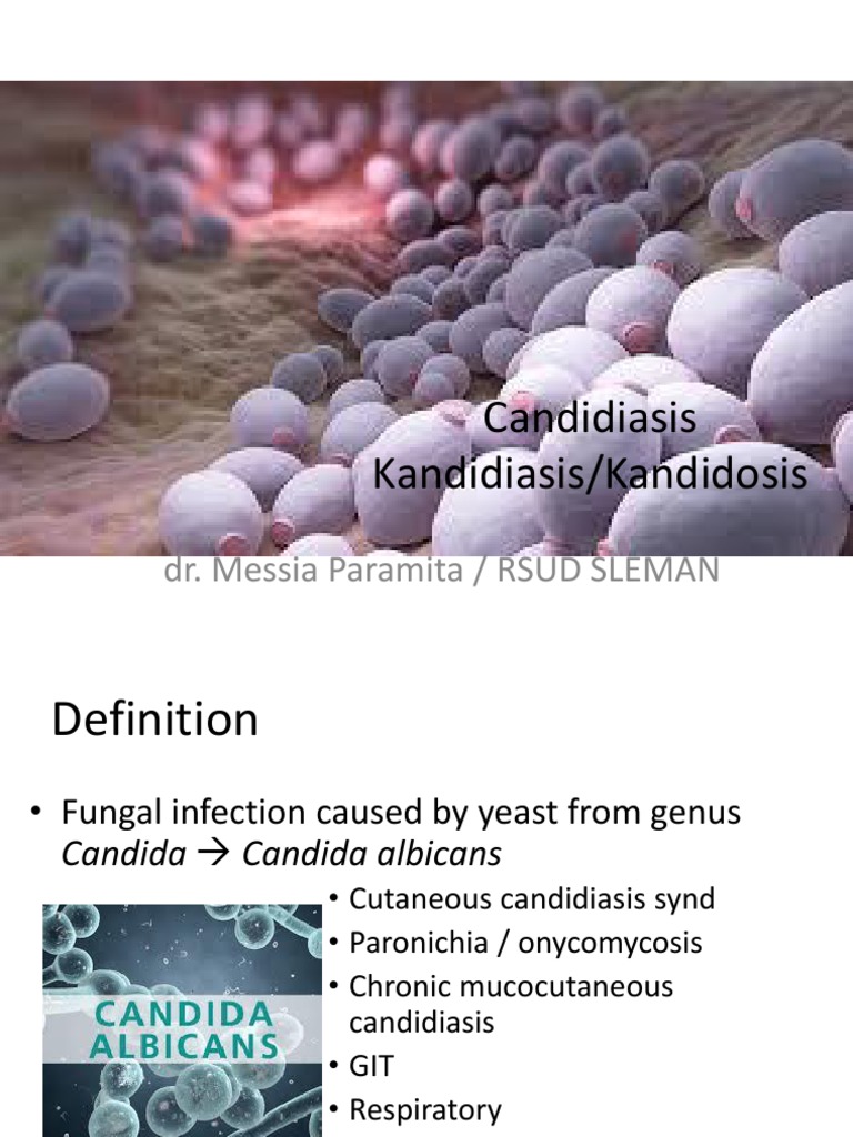 Candidiasis Kandidiasis/Kandidosis: Dr. Messia Paramita / RSUD SLEMAN ...