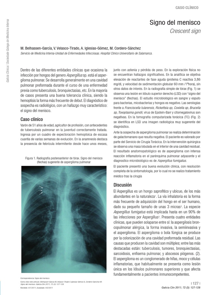 Signo del menisco | El embarazo | Amamantamiento
