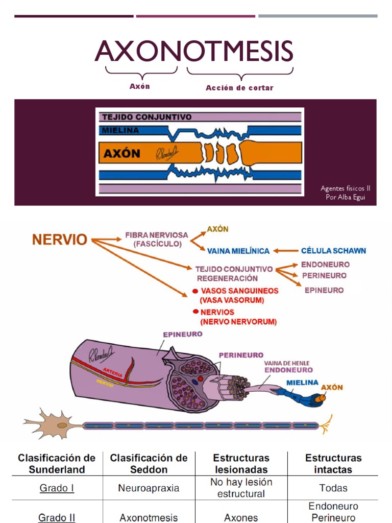 Axonotmesis power point