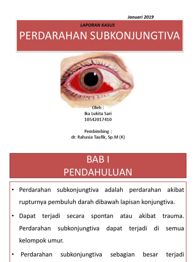 Perdarahan Subkonjungtiva | PDF