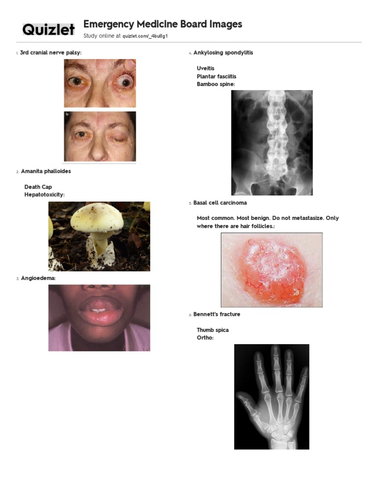 EM Boards Pics | PDF | Medical Specialties | Diseases And Disorders