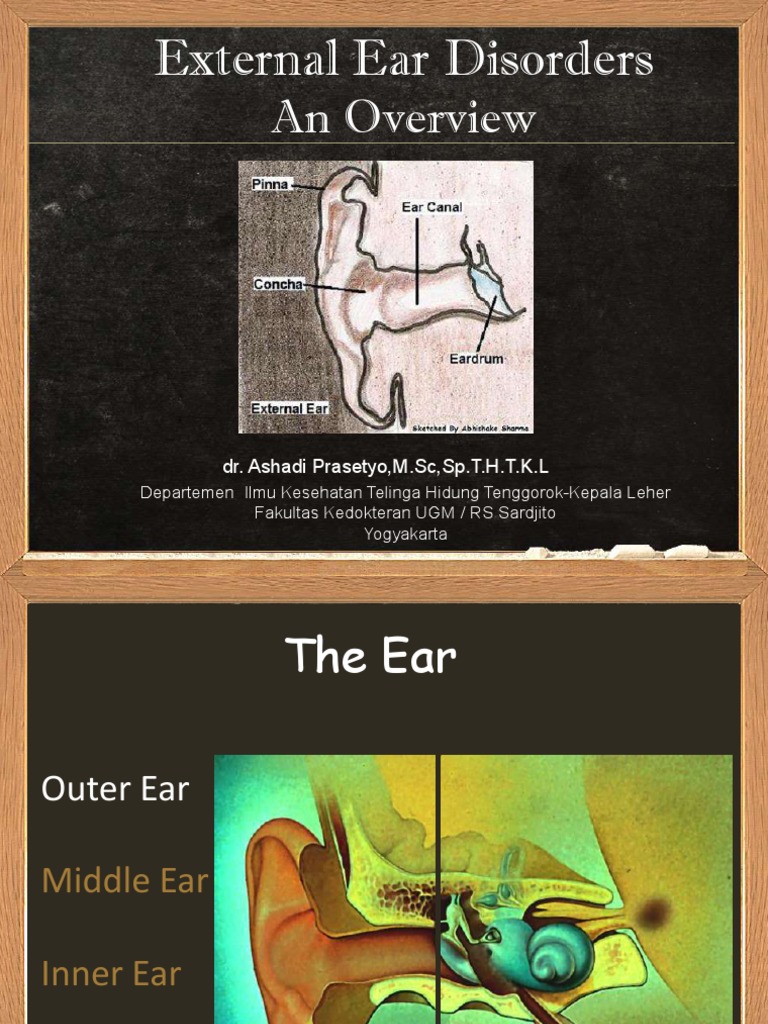 Overview of External Ear Disorders | PDF | Ear | Otology