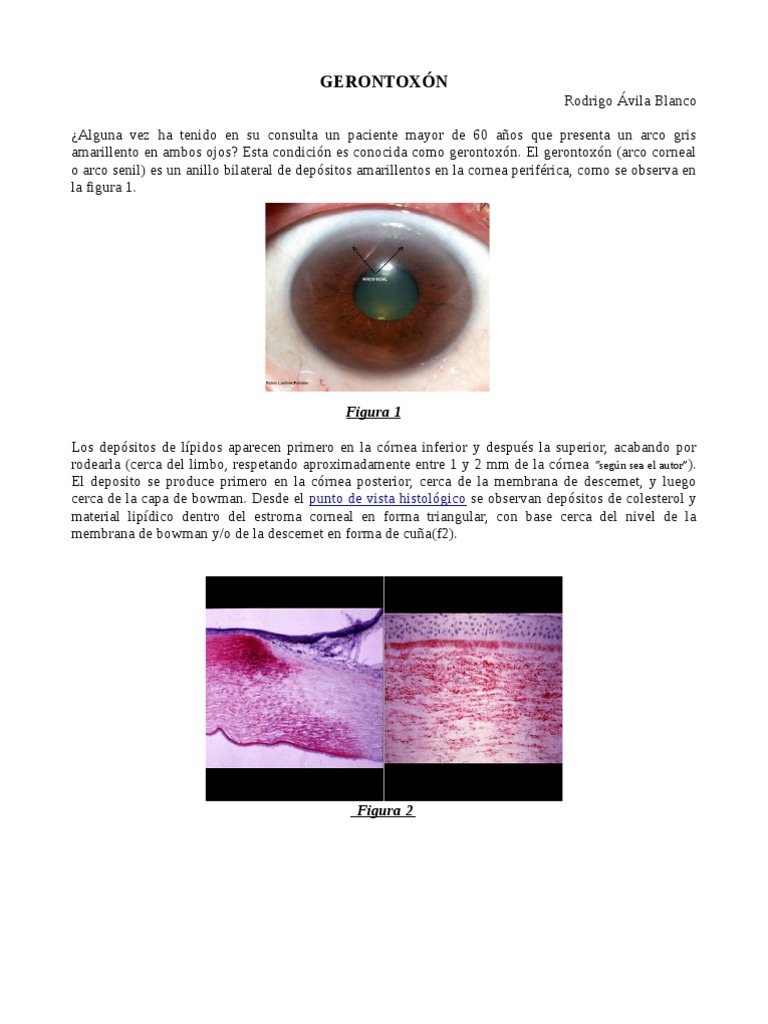 Gerontoxón RAB | PDF | Membrana celular | Lípido