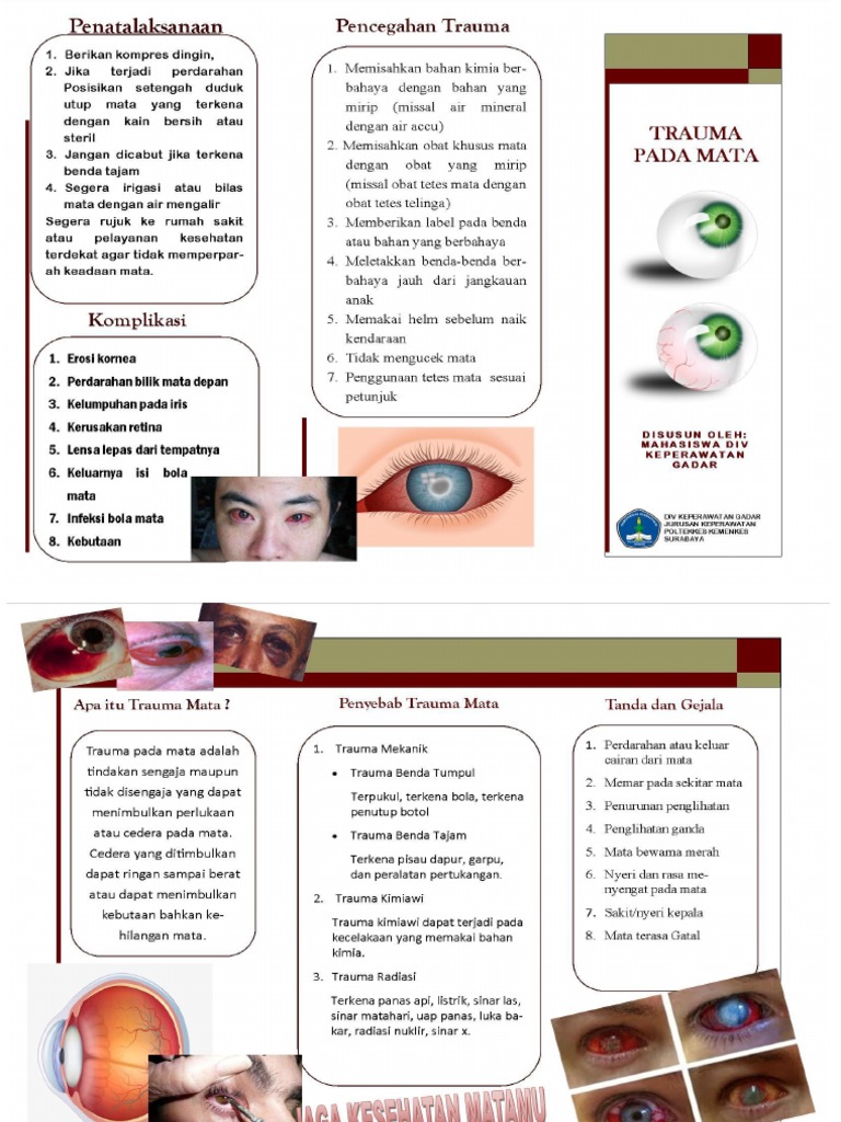 Leaflet Trauma Okuli Ok | PDF