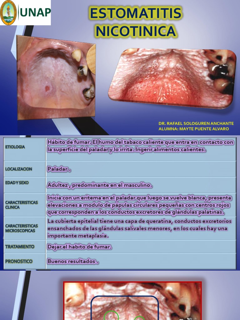 ESTOMATITIS | PDF