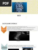 Trastornos Del Bazo | PDF | Metástasis | Bazo