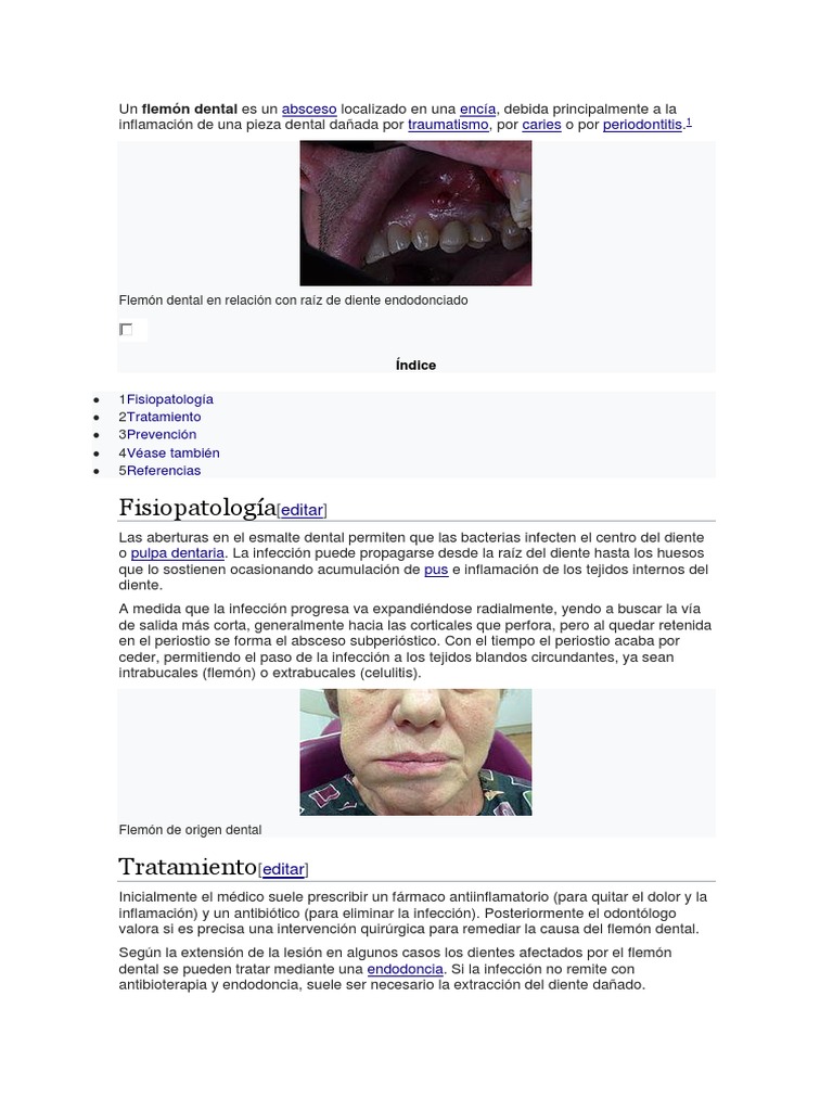 Flemon | PDF | Rtt | Inmunología