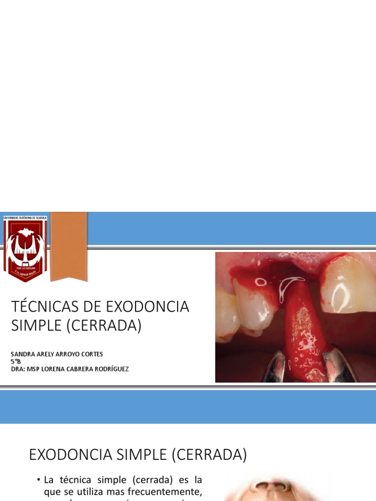 Exodoncia Simple | Ramas de Odontología | Anatomia dental