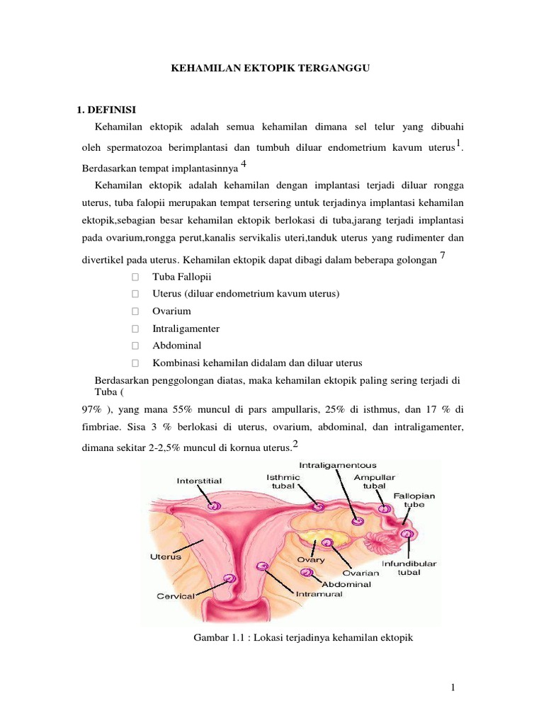Kehamilan Ektopik Terganggu | PDF