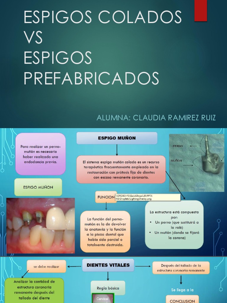 Espigos Colados Vs Prefabricado | PDF