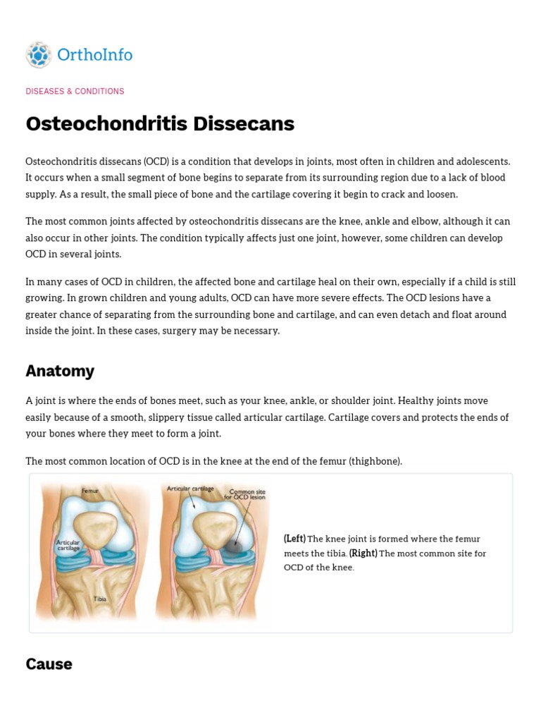 Osteochondritis Dissecans - OrthoInfo - AAOS PDF | PDF | Clinical ...