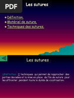 Points de Suture | PDF | Suture (médecine) | Médecine clinique