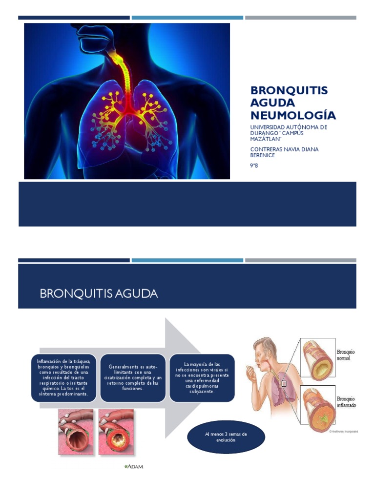 Bronquitis Aguda | PDF | Tos | Neumonía