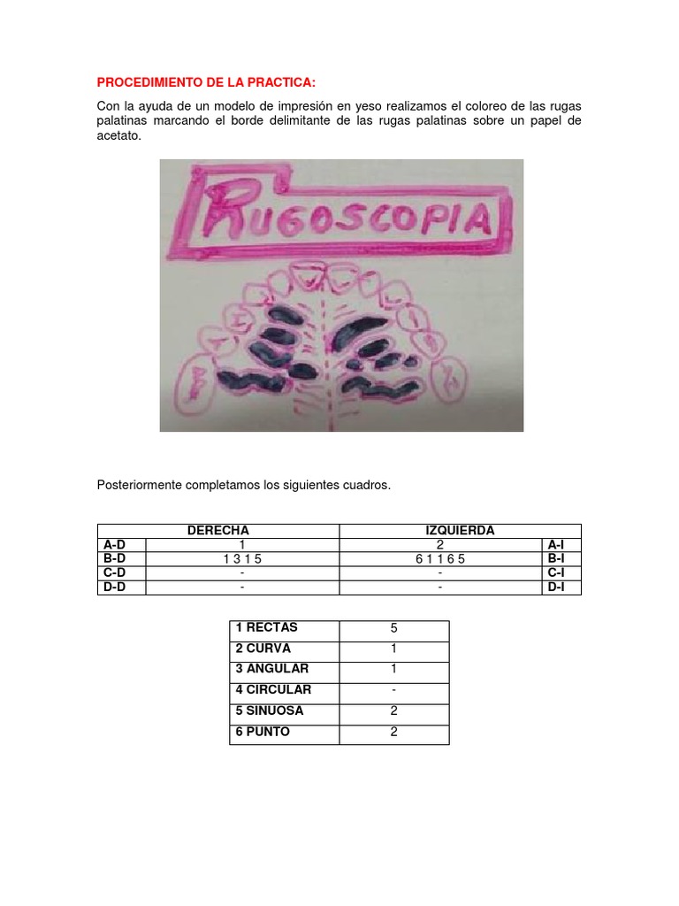 rugoscopia | Odontología | Hueso