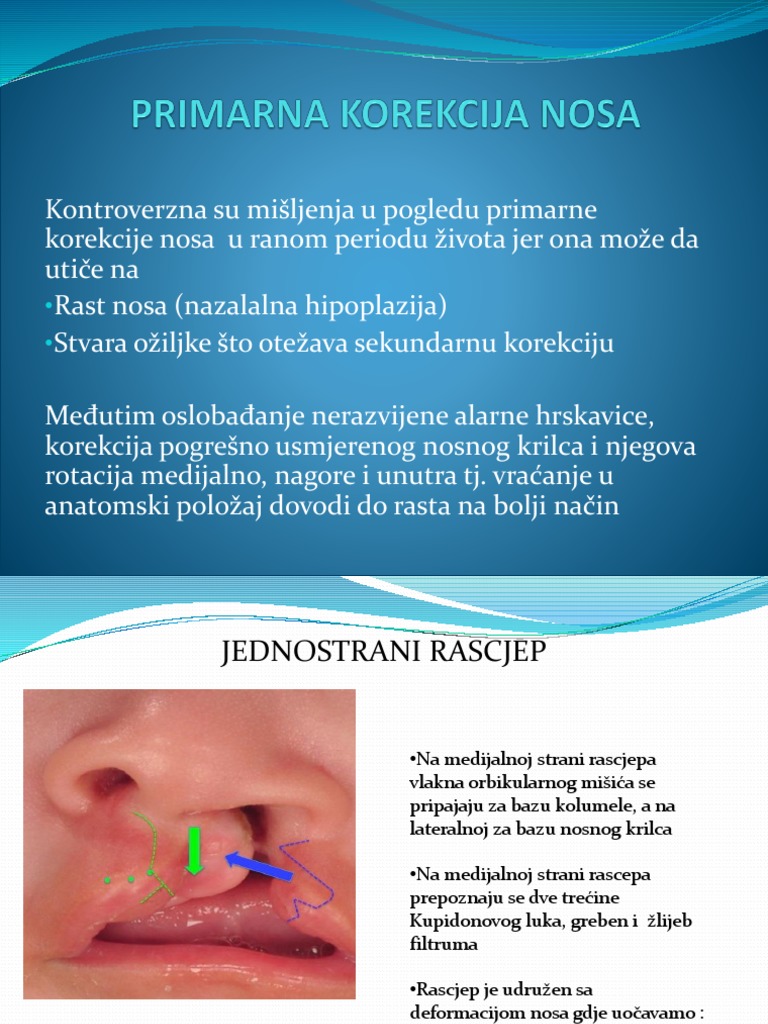 Primarna Korekcija Nosa | PDF