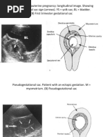 Fetal Heart Tone Evaluation Guide | PDF | Fetus | Heart