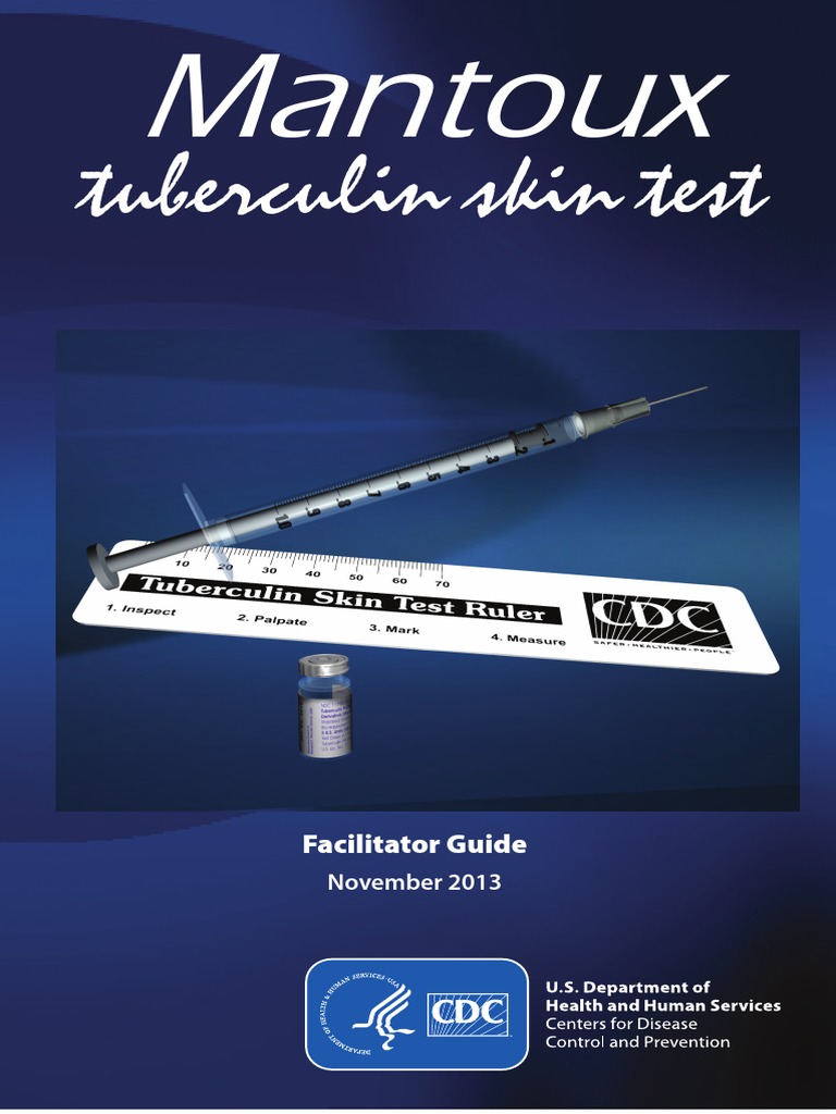 Tuberculin Skin Test: Mantoux | Download Free PDF | Tuberculosis ...