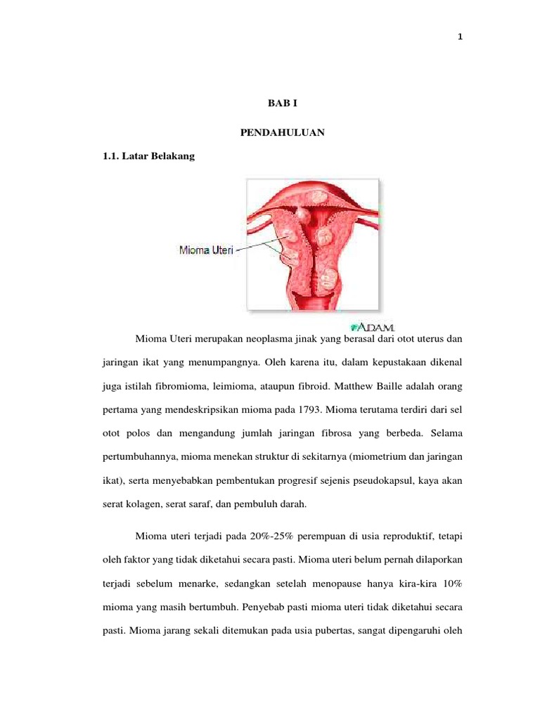 Lapsus - Myoma Uteri Dengan Infertilitas Primer | PDF