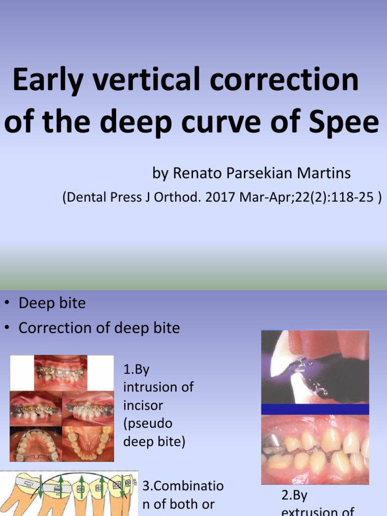 Early Vertical Correction | PDF | Orthodontics | Mouth