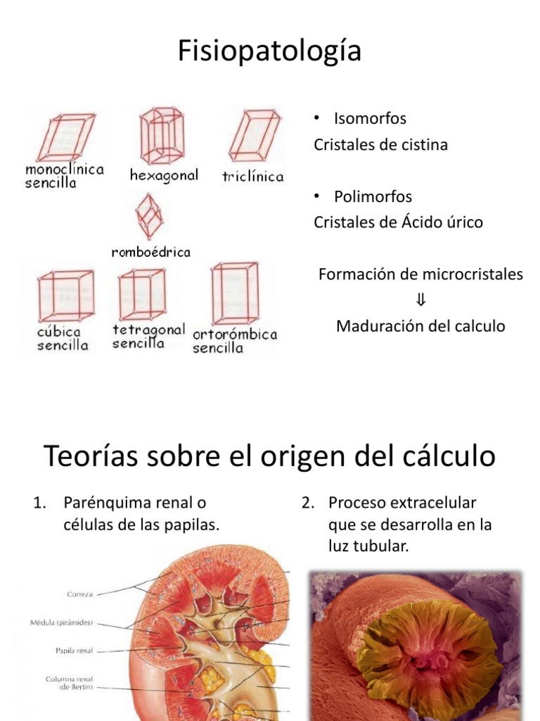 Urolitiasis Fisiopatología | PDF | Orina | Solubilidad