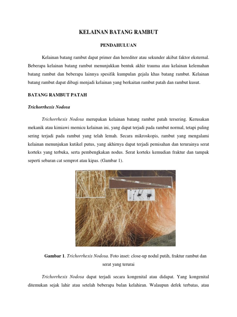 Kelainan Batang Rambut: Jenis dan Diagnosis | PDF