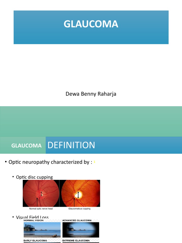 Glaucoma: Dewa Benny Raharja | PDF | Glaucoma | Visual System