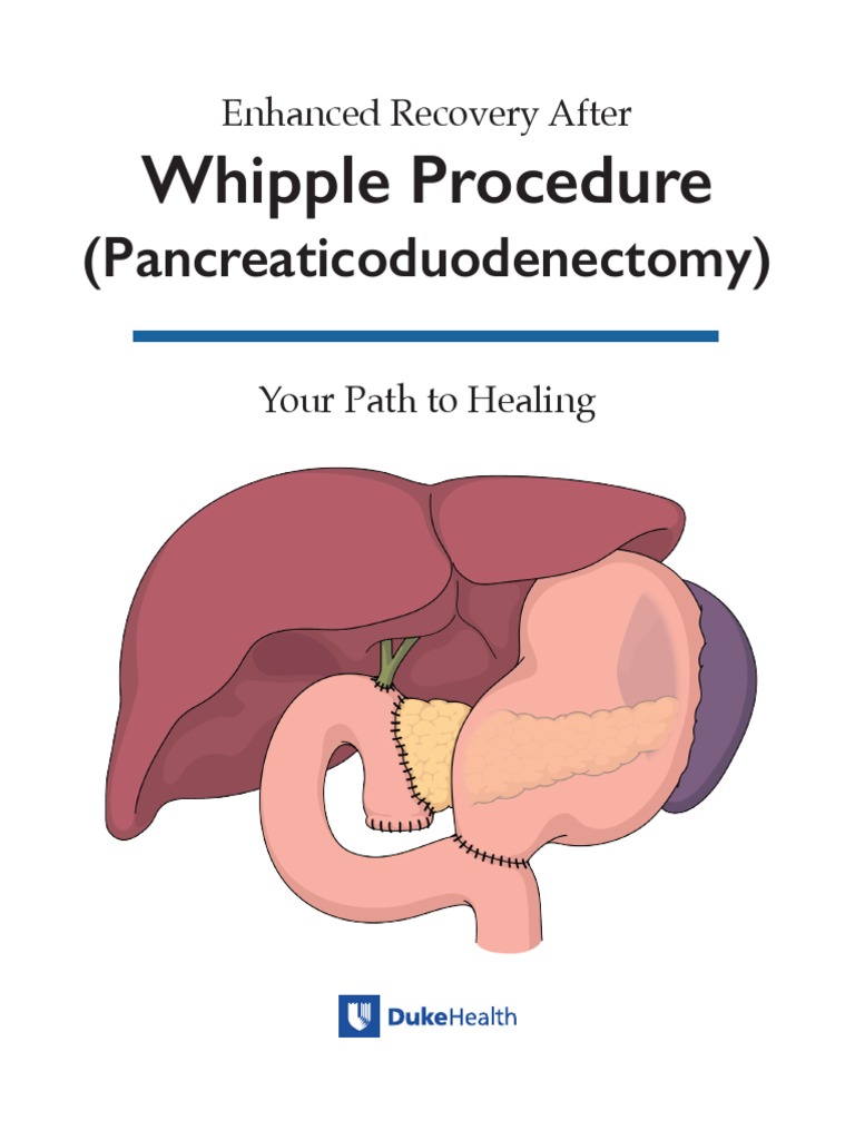 Whipple Procedure: (Pancreaticoduodenectomy) | PDF | Surgery | Pancreas