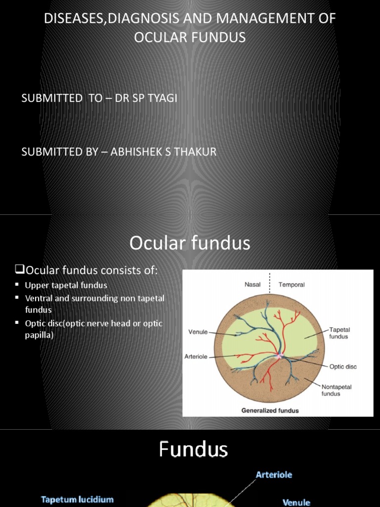 Diseases, Diagnosis and Management of Ocular Fundus | PDF | Retina ...