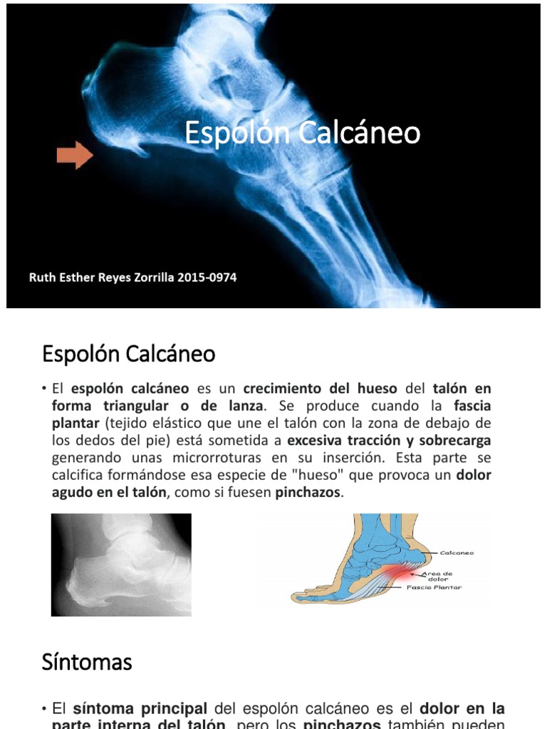 Espolón | PDF | Ciencia y matemáticas