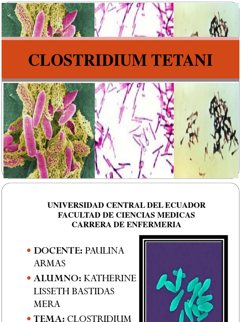 Clostridium Tetani | PDF | Enfermedades y trastornos | Inmunología