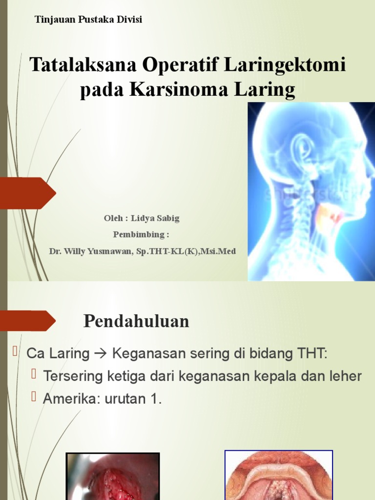 Tatalaksana Laringektomi Karsinoma Laring | PDF