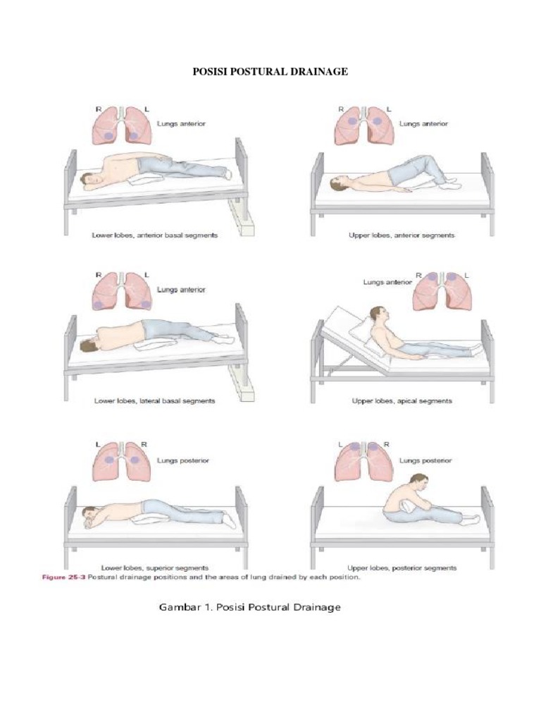 Posisi Postural Drainage | PDF