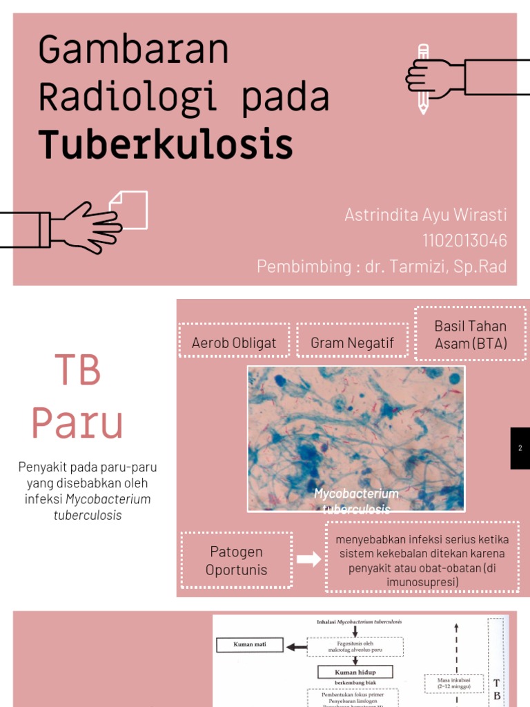 Referat Gambaran Radiologi Thorax TB | PDF