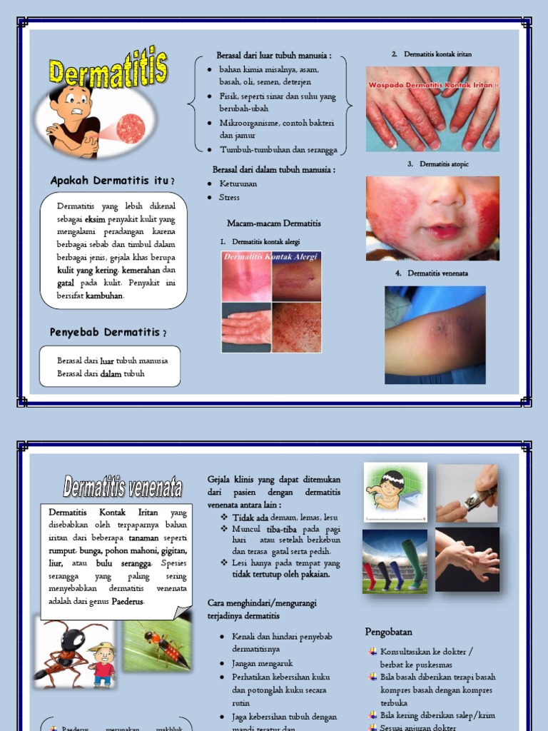 Dermatitis Brosur | PDF