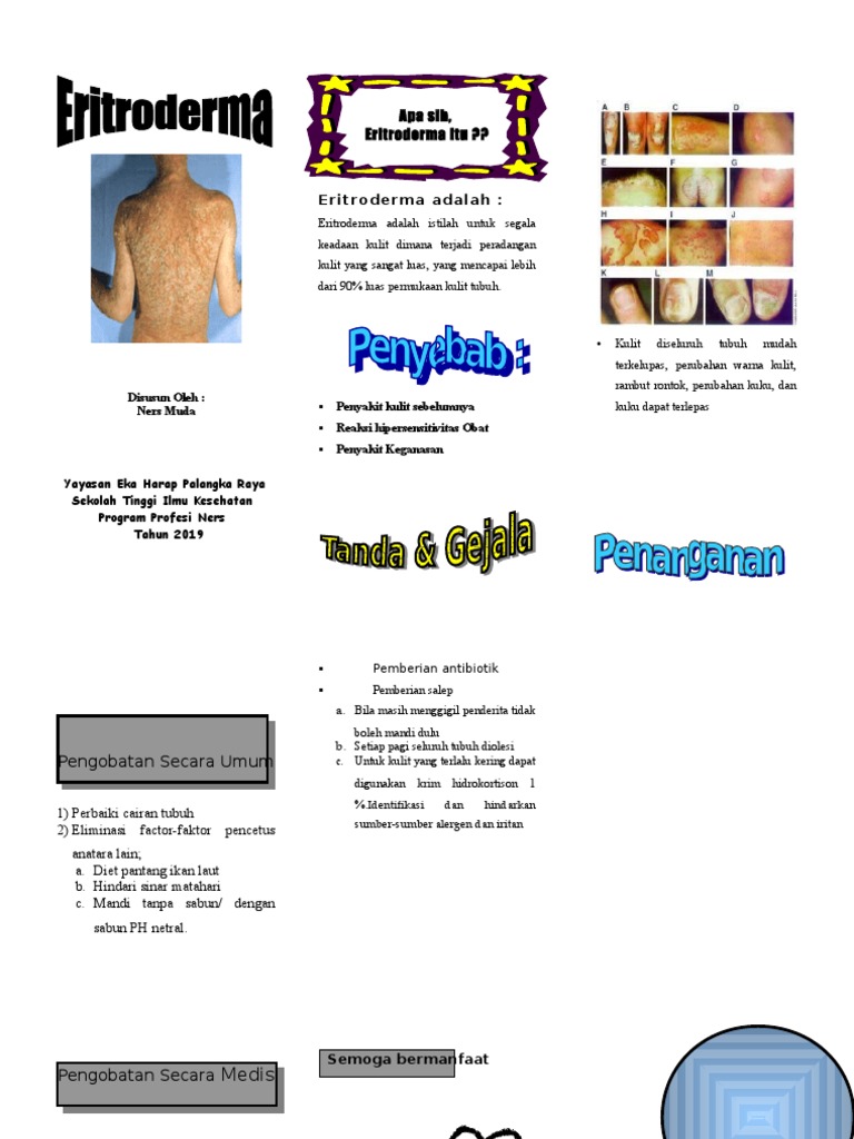 Leaflet Eritroderma | PDF