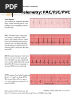 Pac PJC PVC | PDF | Cardiac Electrophysiology | Cardiac Arrhythmia