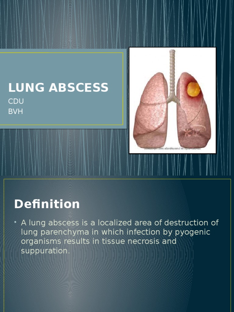 Lung Abscess Symptoms, Causes and Treatment | PDF | Pneumonia ...