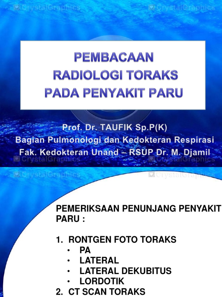 Pembacaan Rontgen Toraks PROF | PDF