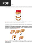 Clasificación de Seibert | PDF | Ciencia y matemáticas