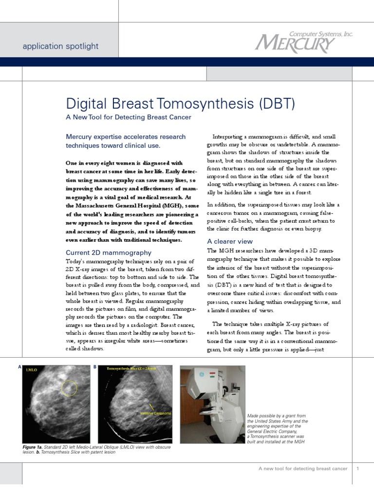 DBT As1 | Download Free PDF | Mammography | Breast Cancer