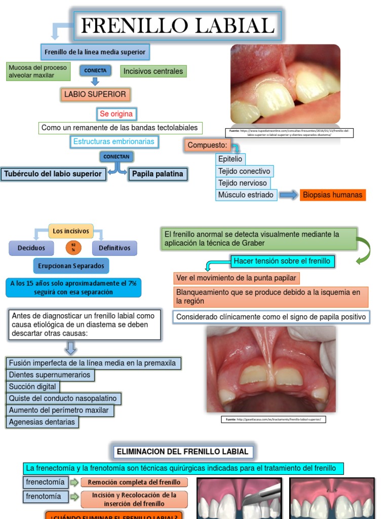 Frenillo Labial | PDF | Ortodoncia | Anatomia animal