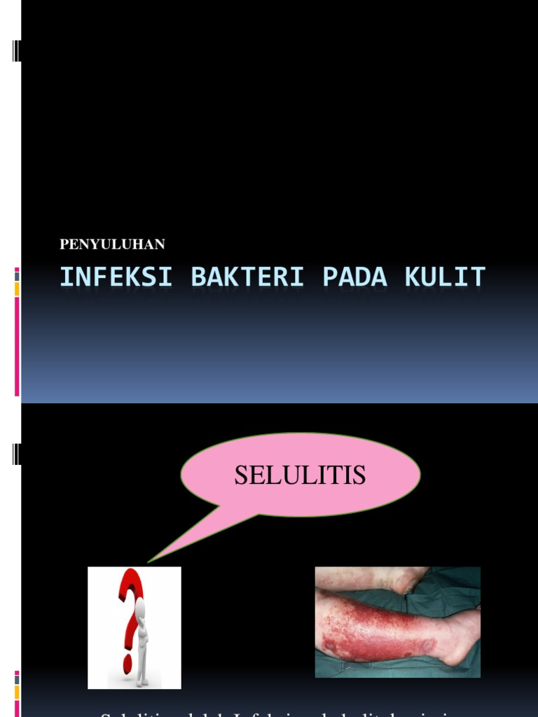 Makalah Selulitis | PDF