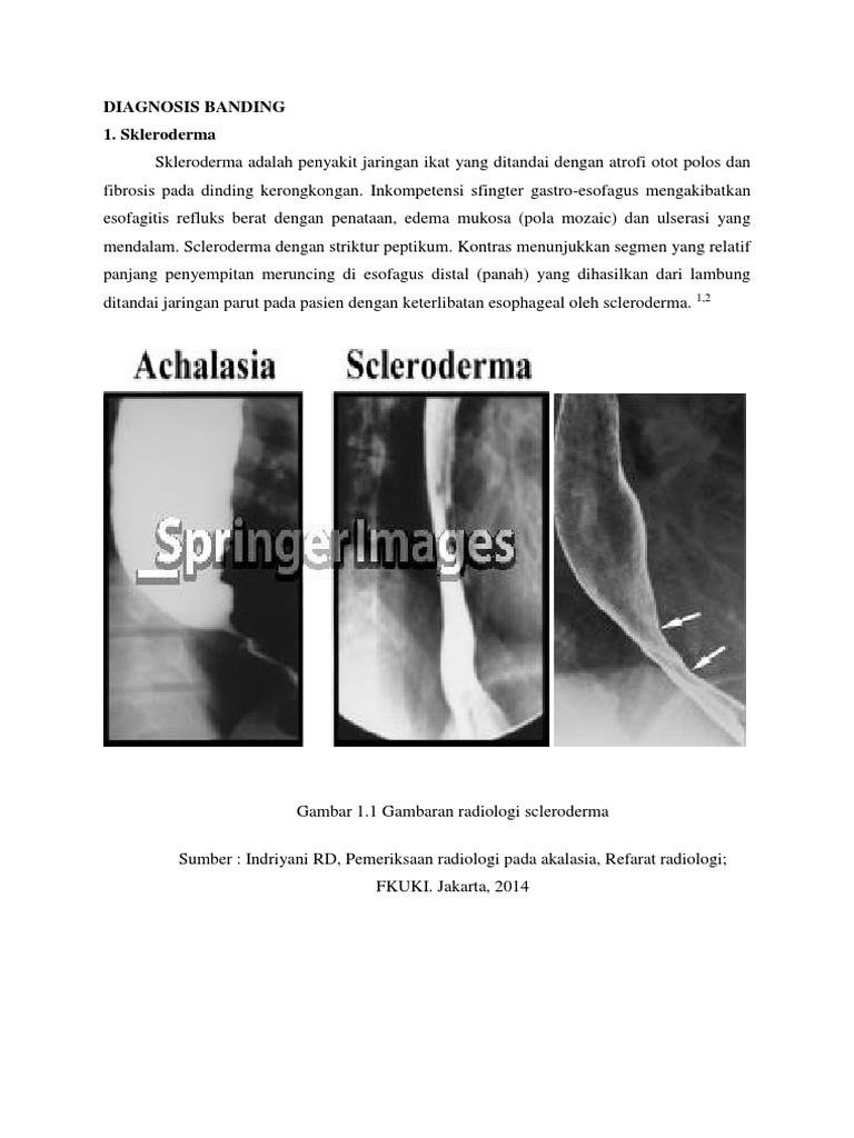 Diagnosis Banding Berdasarkan Gambaran Radiologi pada Skleroderma dan ...