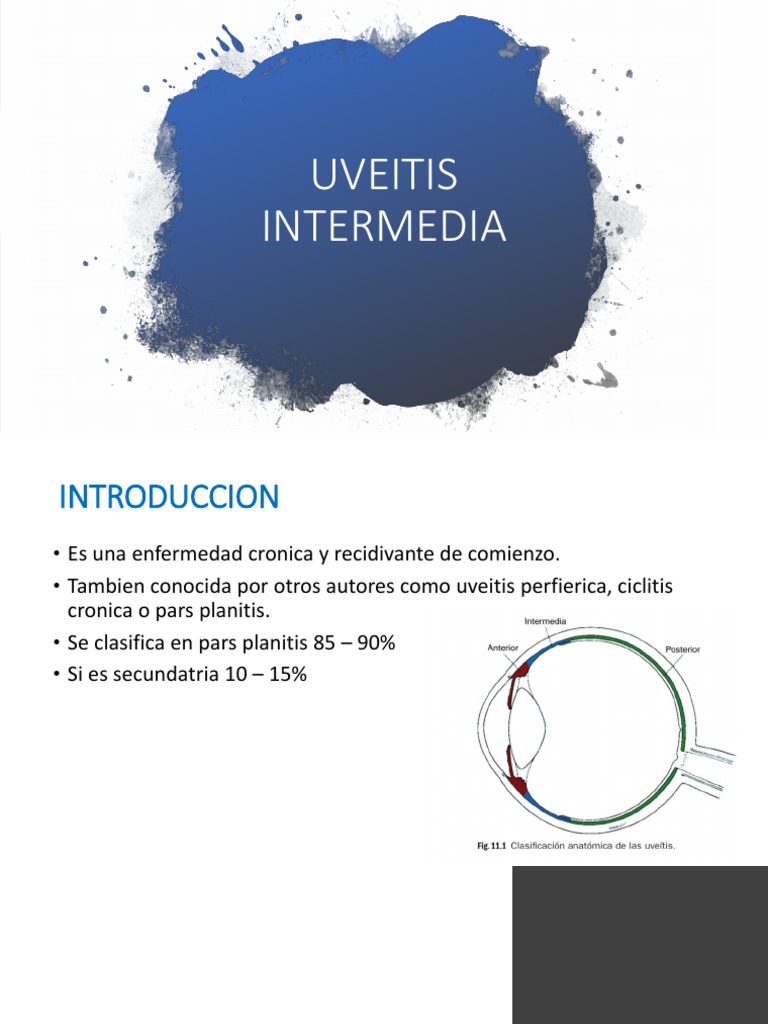 Uveitis Intermedia | PDF | Oftalmología | Inmunología